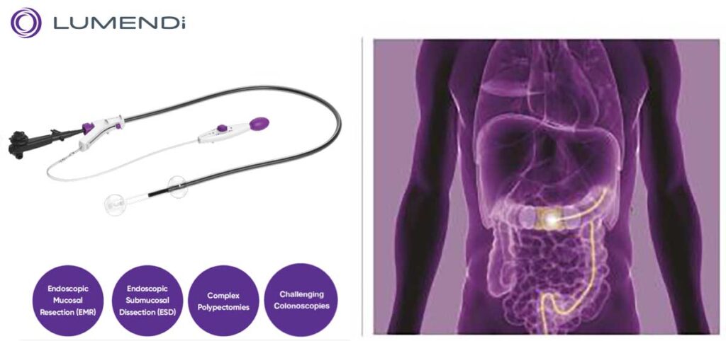 Lumendi Introduces EZ Glide Hydrophilic Coating for Its DiLumen ...
